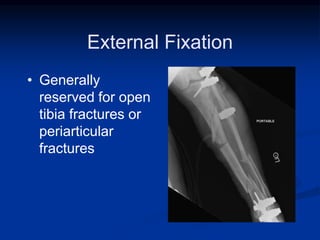 Fracture of Tibia,ankle and foot.ppt