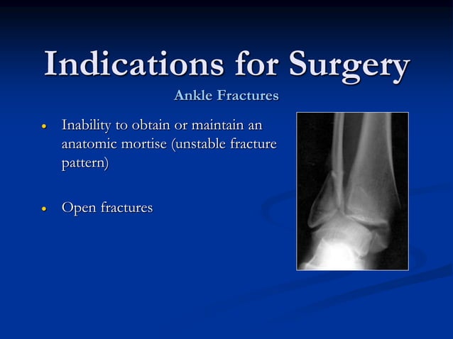 Fracture of Tibia,ankle and foot.ppt