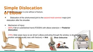 Fracture of Upper Limb Part 2 097826.pptx
