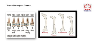 Fracture on X-Ray.examination of cxr pptx | PPT