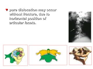Fracture of Pelvis and Spine | PPTX