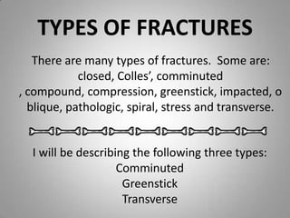 FRACTURE CHAPTER 4 PRESENTATION | PPT