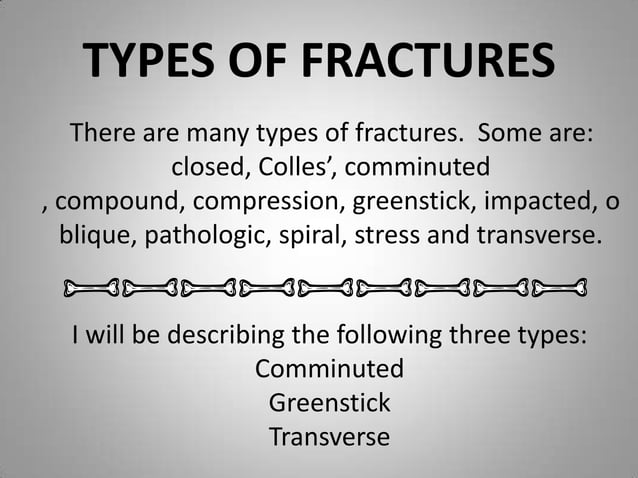 FRACTURE CHAPTER 4 PRESENTATION | PPT