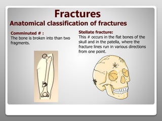 fracture pp.ppt | First Aid | Injuries