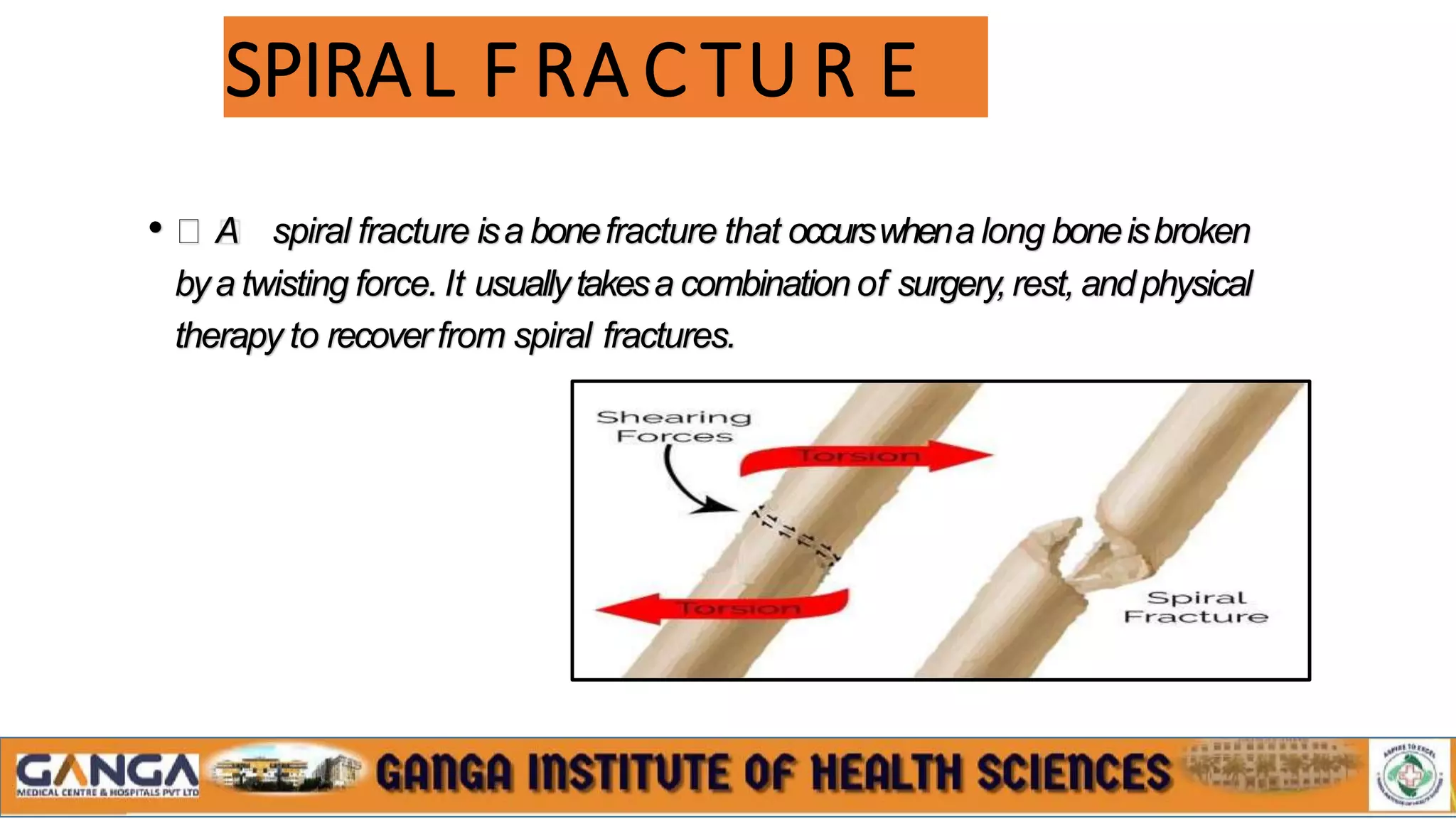 fracture ppt.pptx