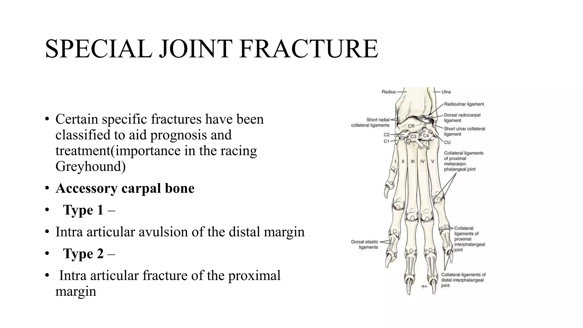 FRACTURE PPT.pptx