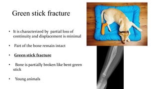 FRACTURE PPT.pptx