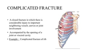 FRACTURE PPT.pptx