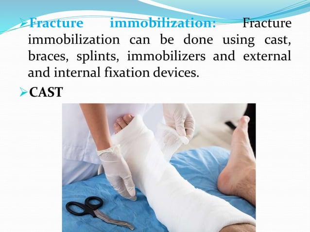 FRACTURE PPT.pptx