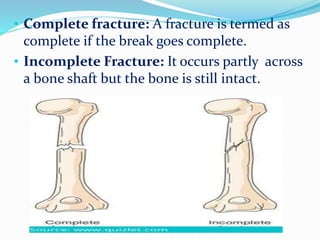 FRACTURE PPT.pptx
