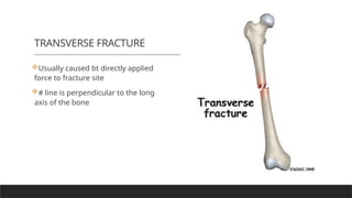 Basic anatomy of Bone , Fracture and Healing | PPTX