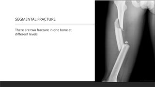 Basic anatomy of Bone , Fracture and Healing | PPTX