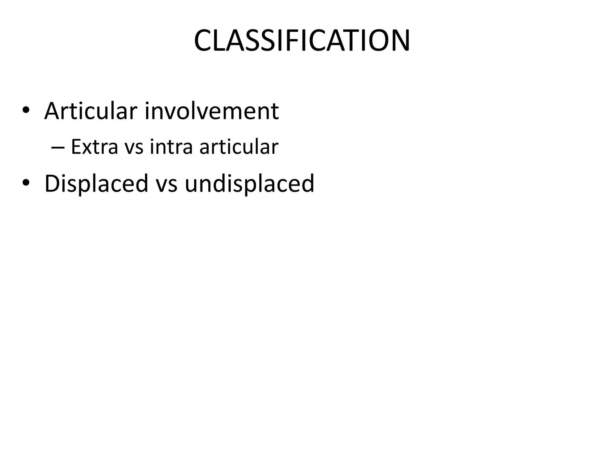 Fracture principle | PPTX