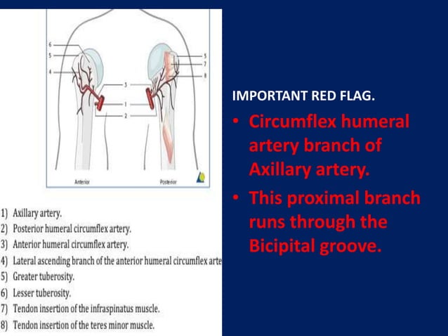Fracture proximal humerus Fixation with K wires and External fixator | PPTX