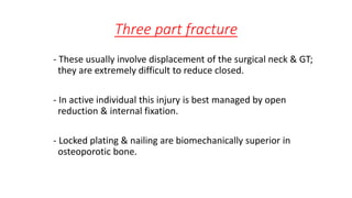 Fracture proximal humerus | PPTX