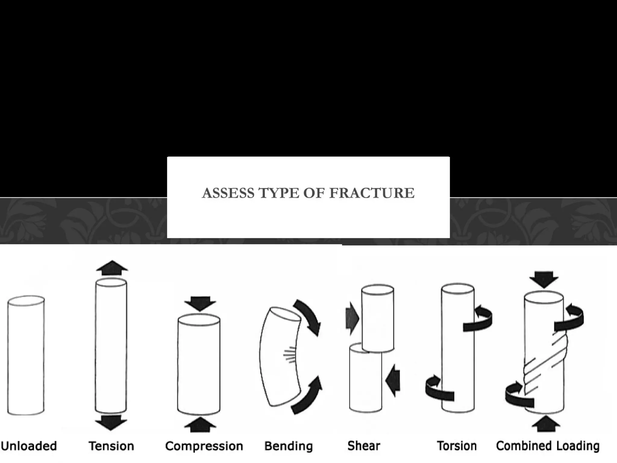 FRACTURE REPORTING TECHNIQUES FOR MEDICOS | PPT