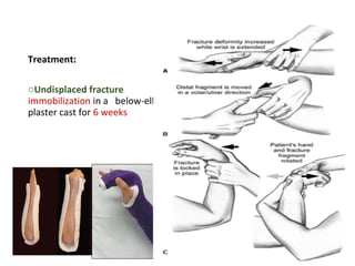 distal radius & scaphoid fracture | PPT