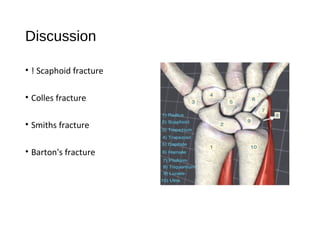 distal radius & scaphoid fracture | PPT
