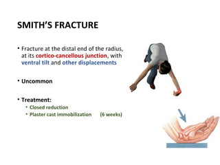 distal radius & scaphoid fracture | PPT | Death, Injury, or Military ...