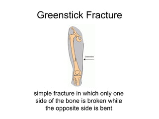 Greenstick Fracture Diagram
