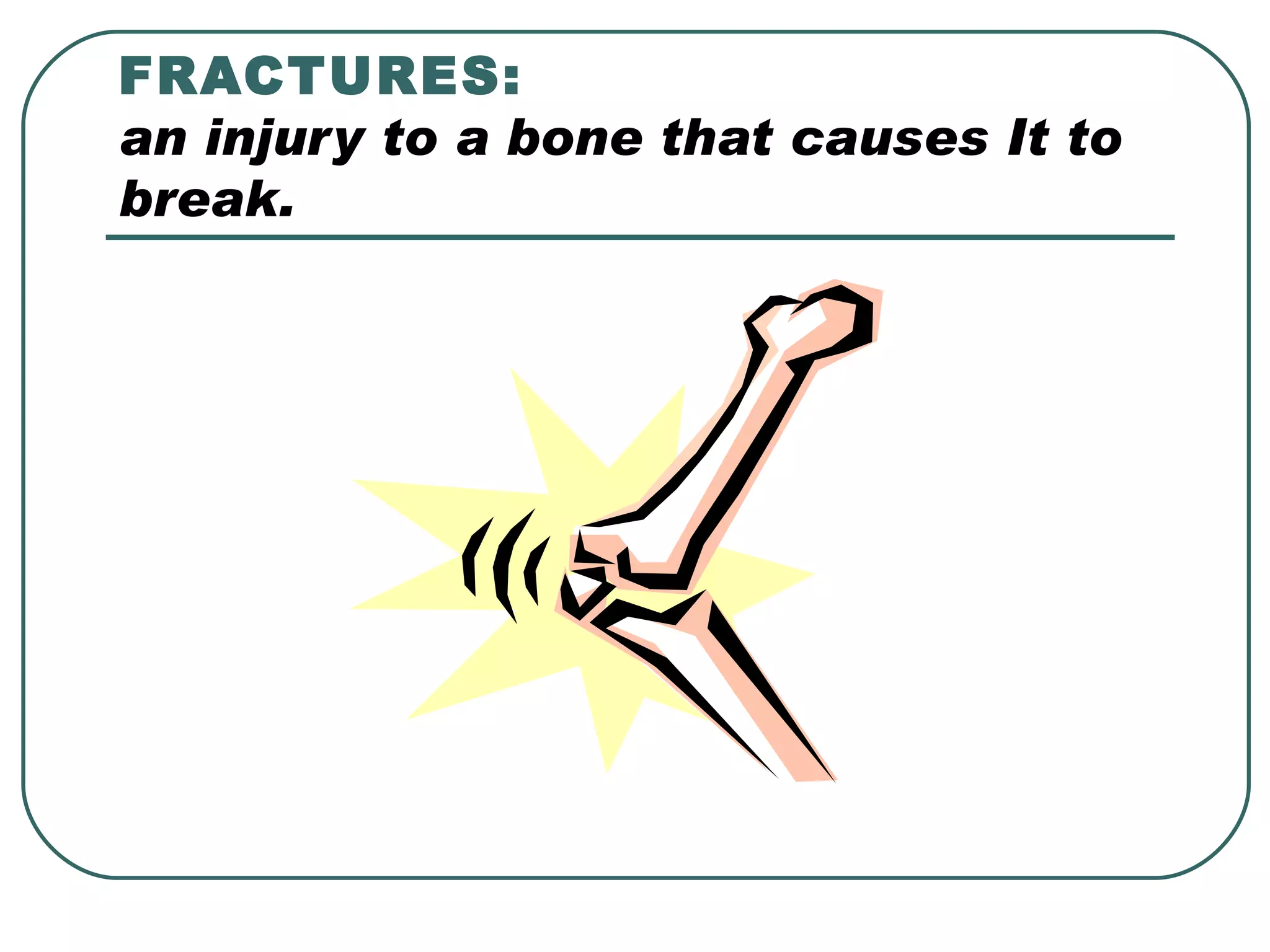 Fractures | PPT