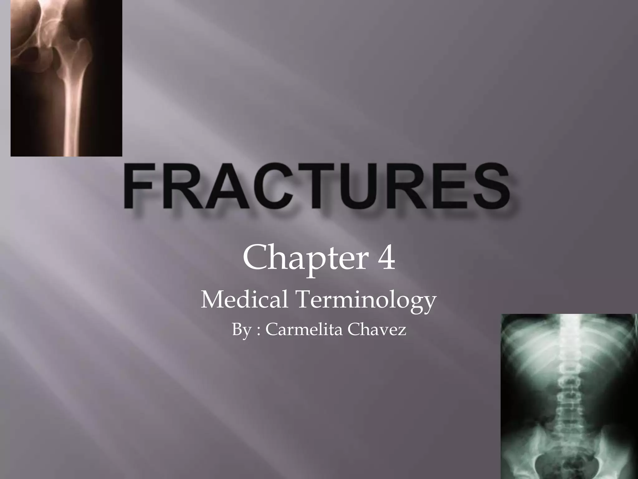 Fractures | PPT
