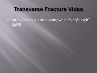 Fractures | PPTX