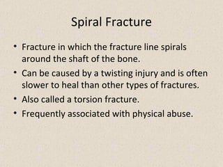 Fractures | PPT