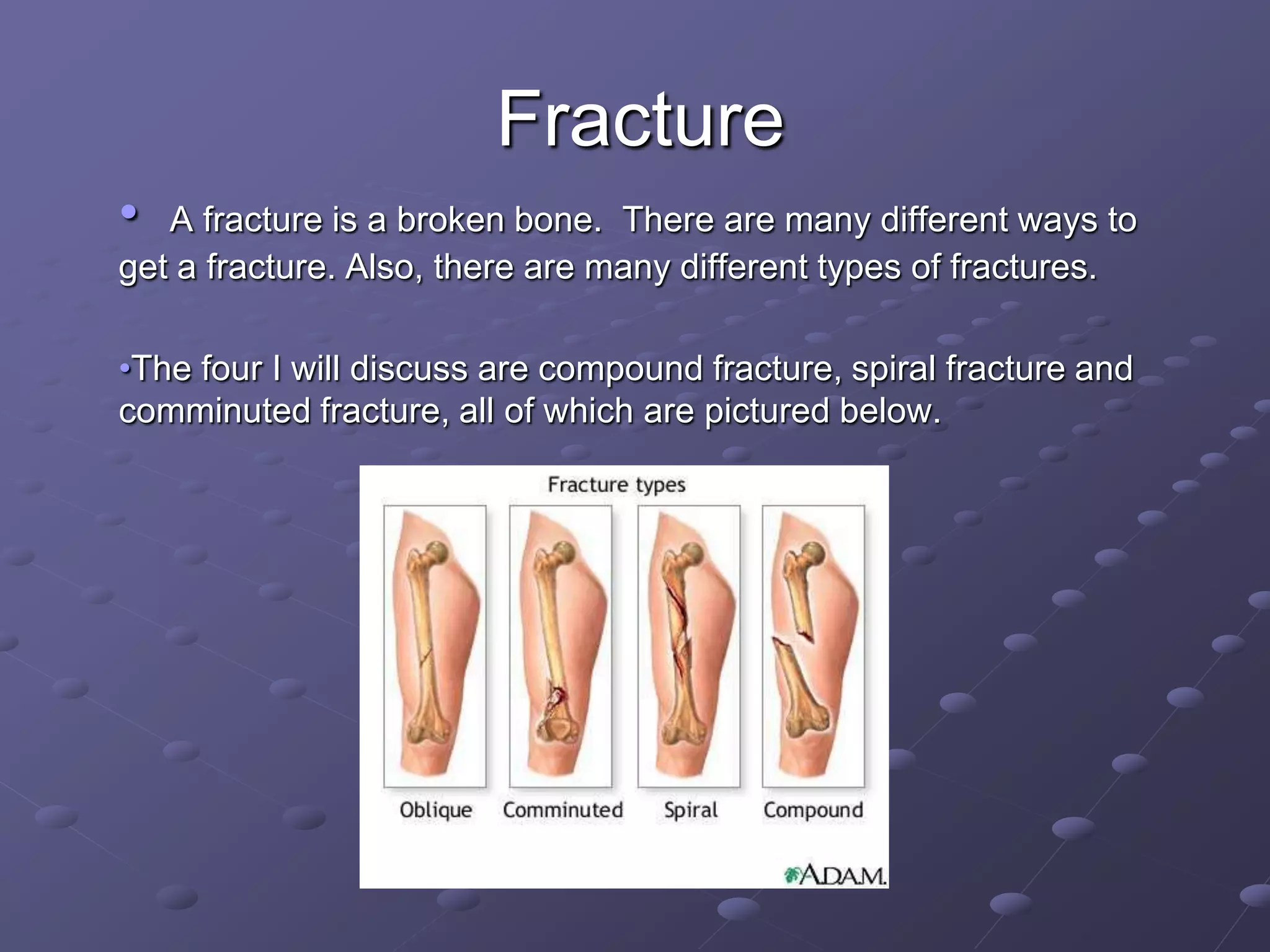 Fractures | PPTX