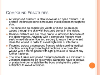 Fractures | PPTX