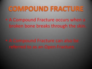 Fractures | PPT