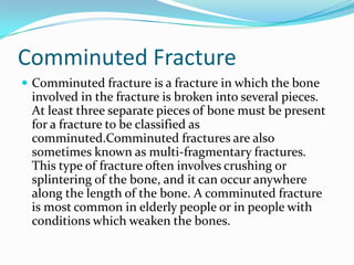 Fractures | PPTX