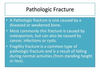 Three Types of Fractures | PPT