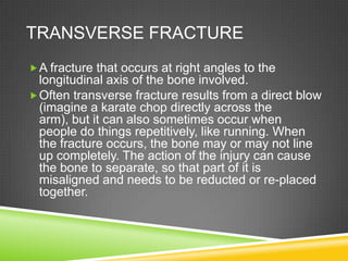 Fractures | PPTX