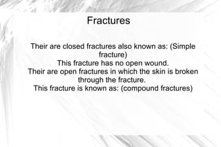 Fractures | ODP
