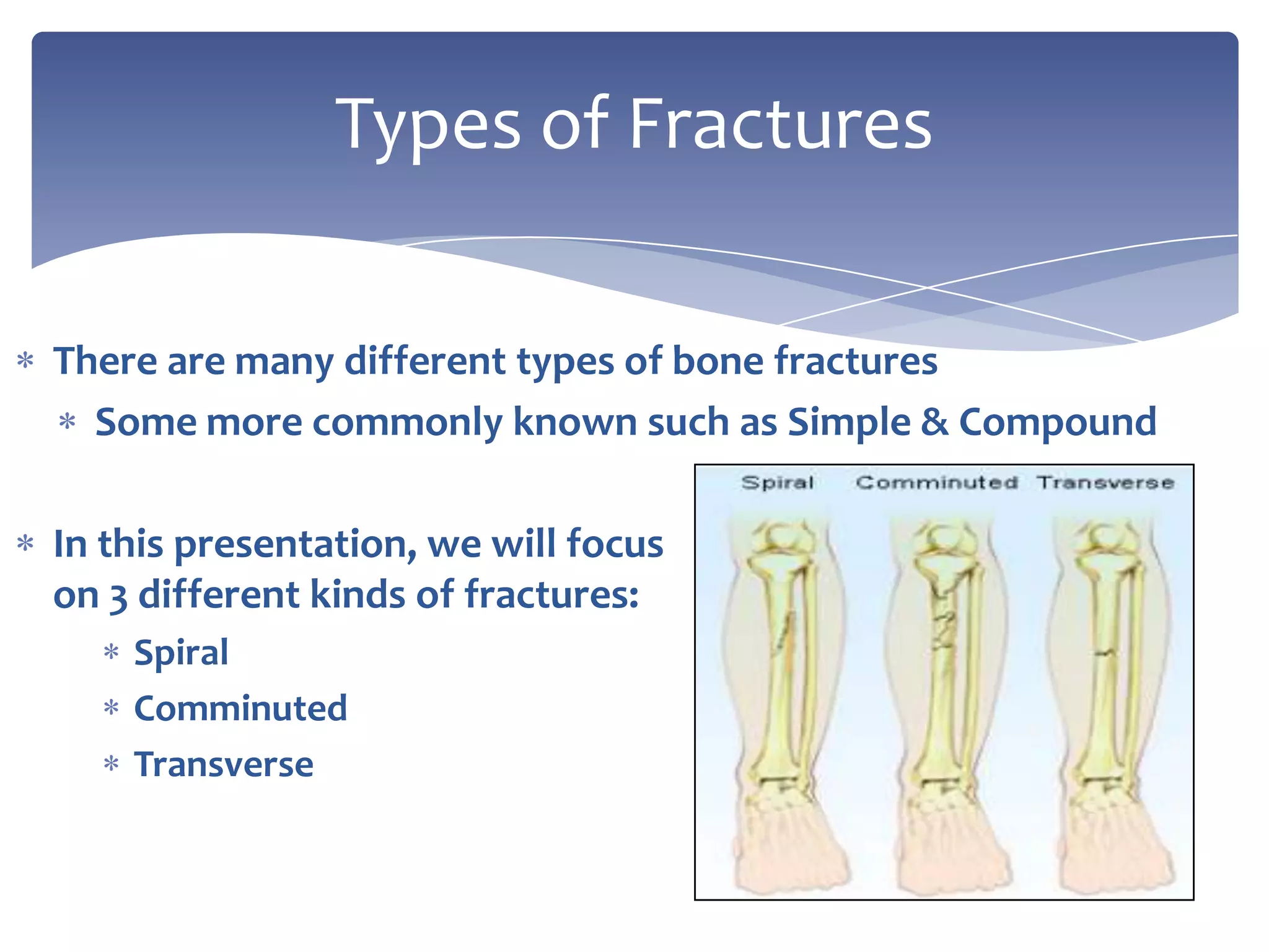 Fractures | PPTX