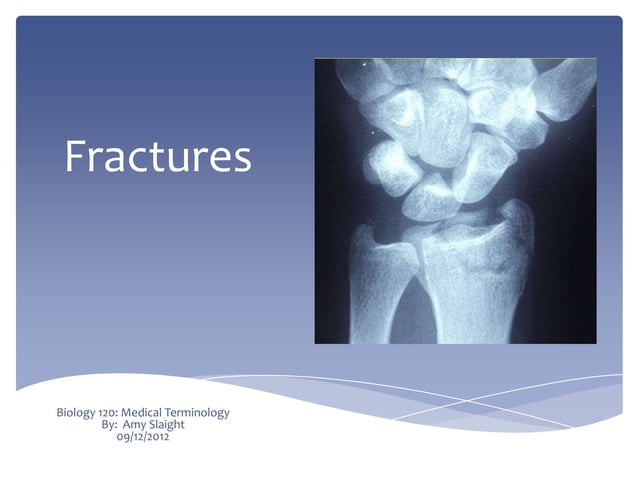Fractures | PPT