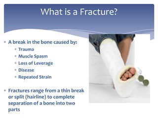 Fractures | PPTX