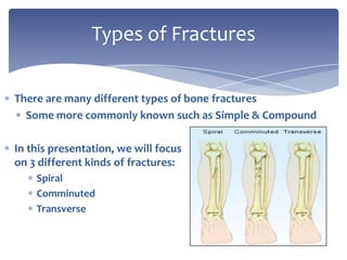 Fractures | PPTX