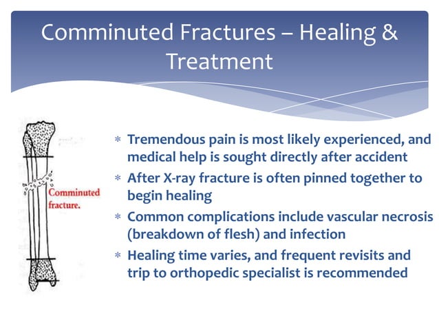 Fractures | PPT