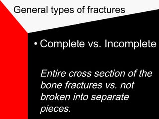 Fractures | PPT