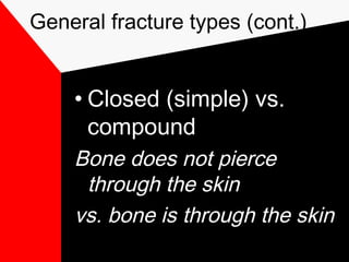 Fractures | PPT