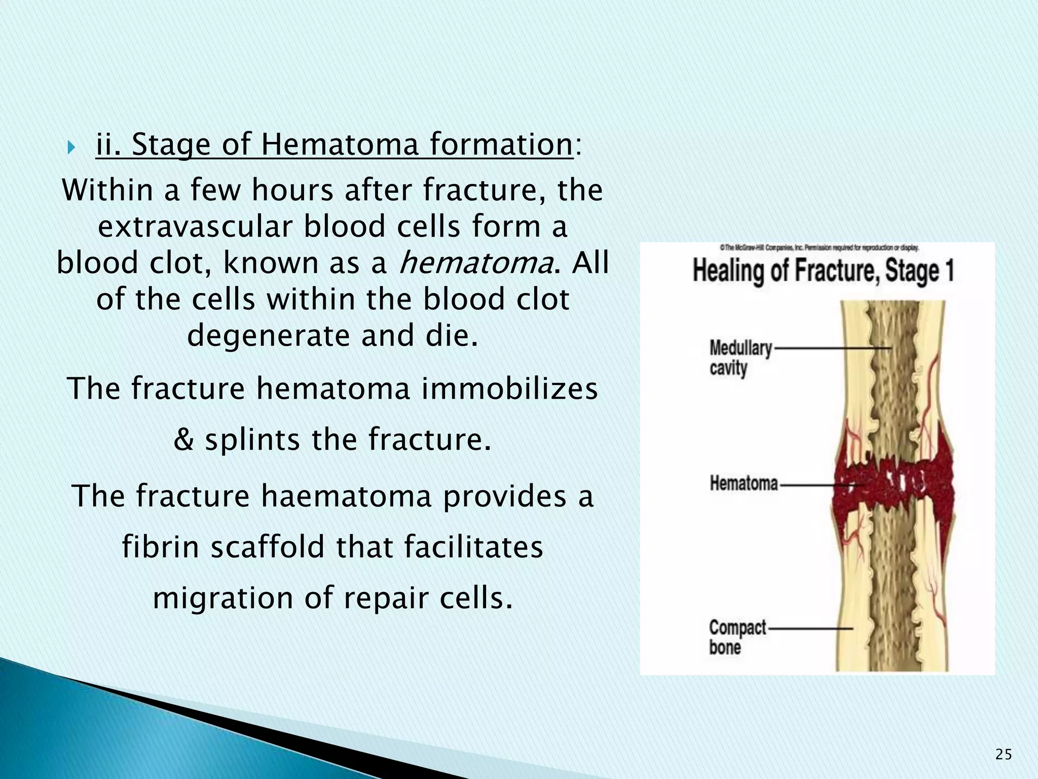 Fractures...types and healing of fractures | PPTX