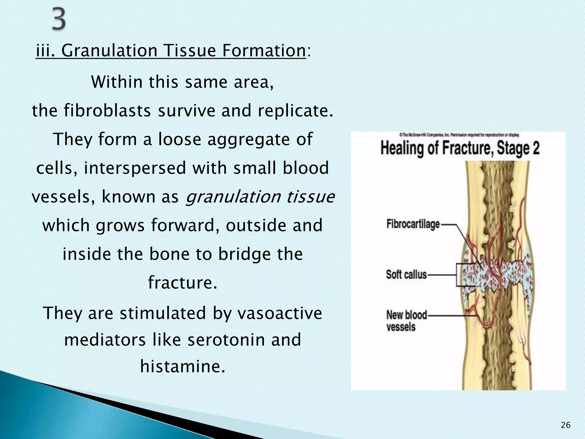 Fractures...types and healing of fractures | PPTX