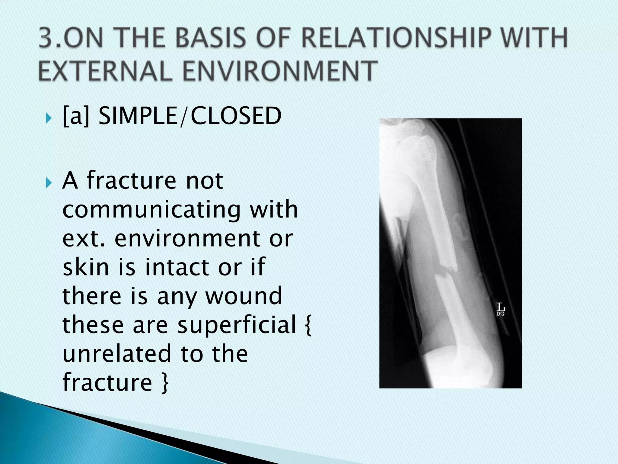 Fractures...types and healing of fractures | PPTX