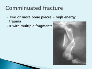 Fractures...types and healing of fractures | PPTX