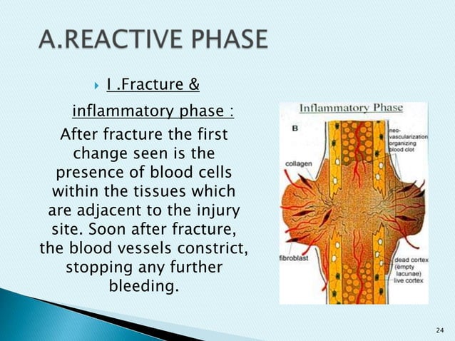 Fractures...types and healing of fractures | PPTX