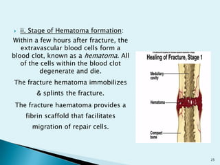 Fractures...types and healing of fractures | PPTX