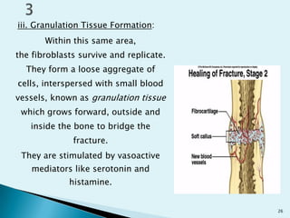 Fractures...types and healing of fractures | PPTX