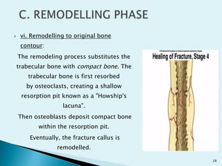 Fractures...types and healing of fractures | PPTX